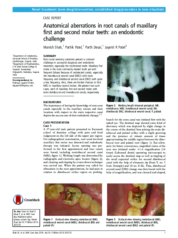 (PDF) Anatomical aberrations in root canals of maxillary first and ...