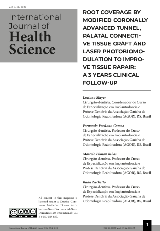(PDF) ROOT COVERAGE BY MODIFIED CORONALLY ADVANCED TUNNEL, PALATAL ...