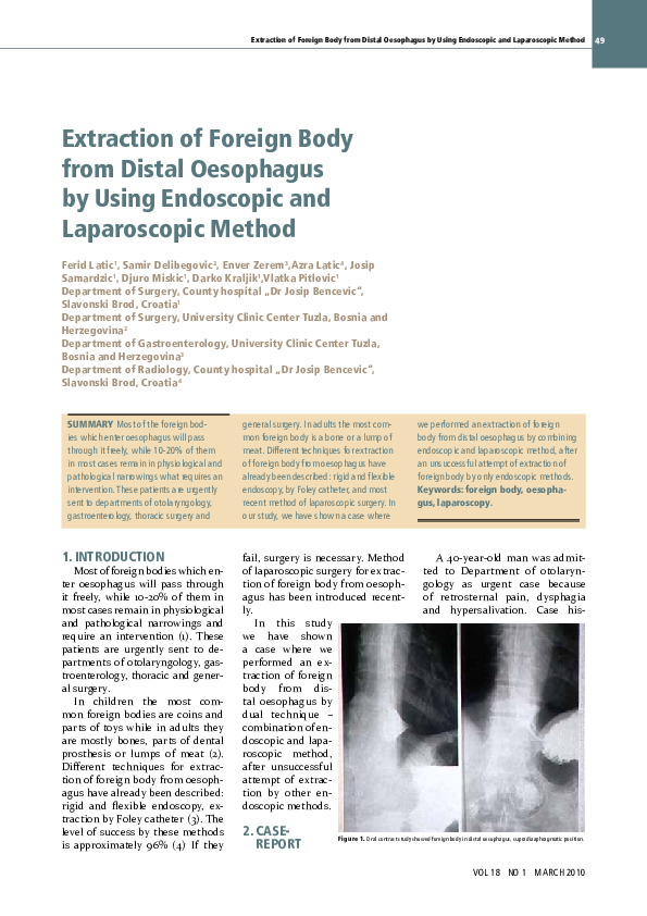 (PDF) Extraction of Foreign Body from Distal Oesophagus by Using ...