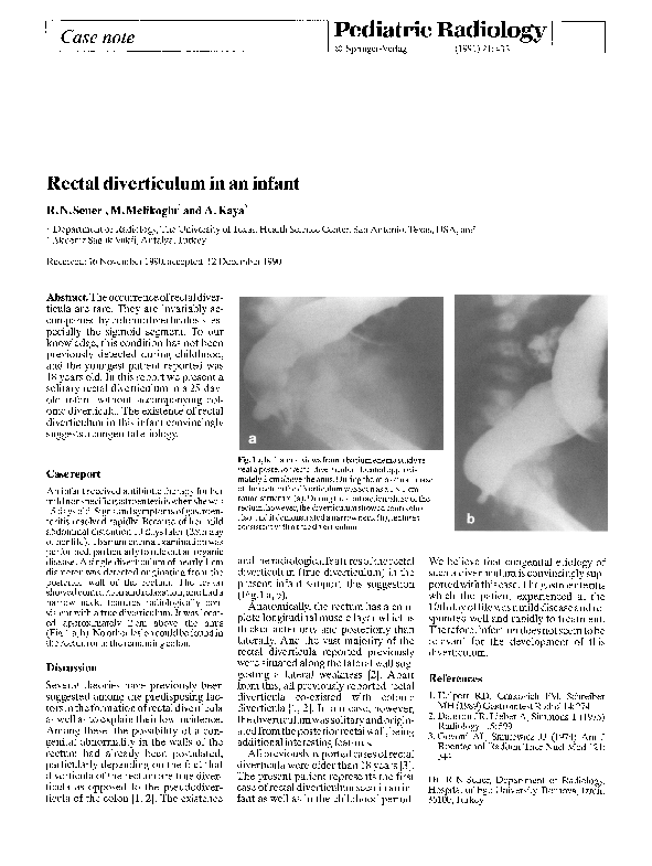 (PDF) Rectal diverticulum in an infant