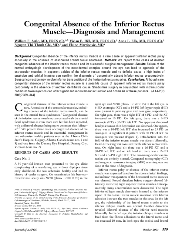 (PDF) Congenital absence of the inferior rectus muscle—diagnosis and ...