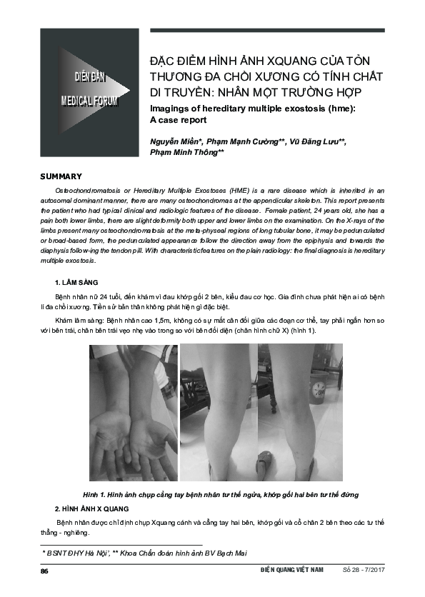 (PDF) Đặc Điểm Hình Ảnh Xquang Của Tổn Thương Đa Chồi Xương Có Tính Chất DI Truyền: Nhân Một ...