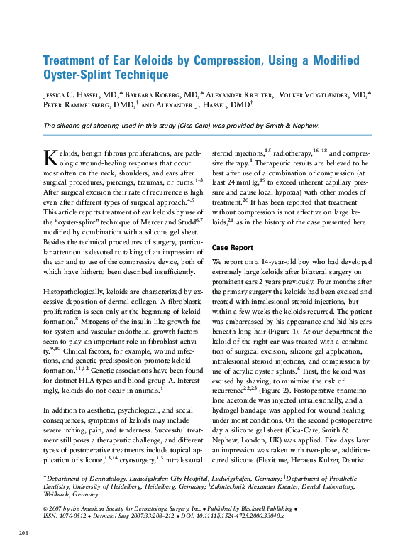 (PDF) Treatment of Ear Keloids by Compression, Using a Modified Oyster ...