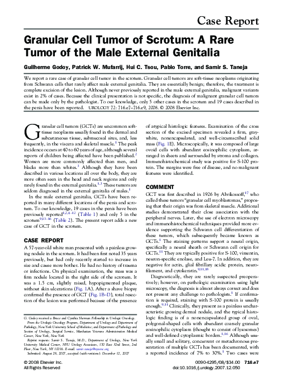 (PDF) Granular Cell Tumor of Scrotum: A Rare Tumor of the Male External ...