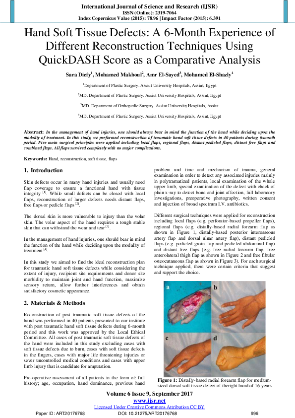 (PDF) Hand Soft Tissue Defects: A 6-Month Experience of Different ...