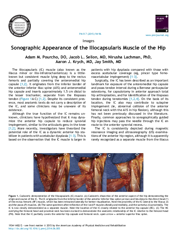 (PDF) Sonographic Appearance of the Iliocapsularis Muscle of the Hip