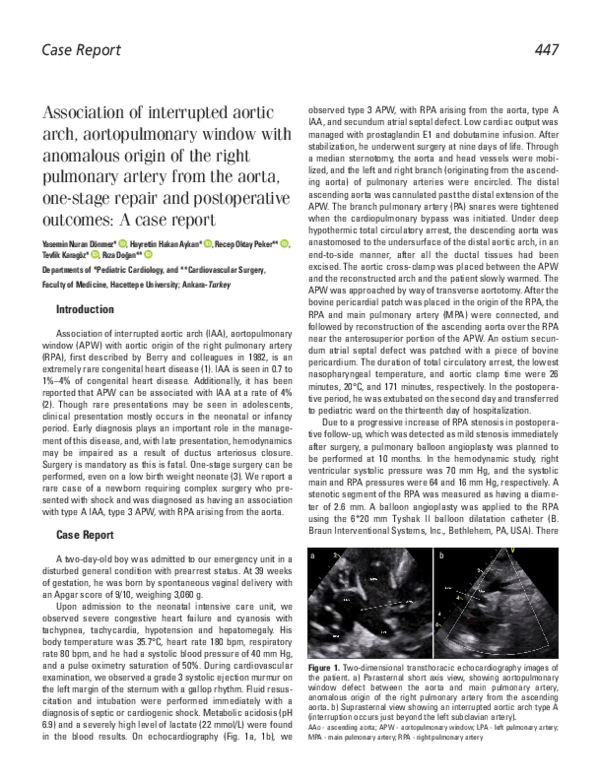 (PDF) Association of Interrupted Aortic Arch, Aortopulmonary Window ...