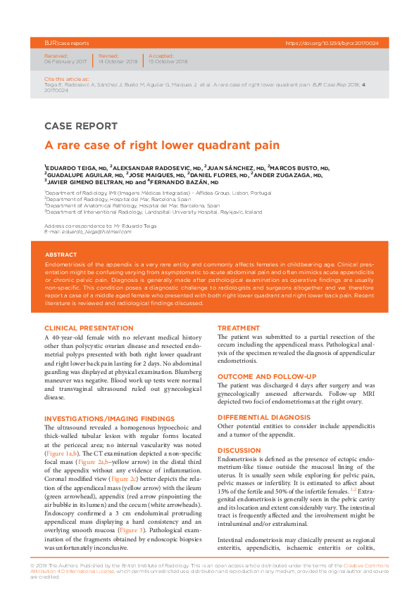 (PDF) A rare case of right lower quadrant pain