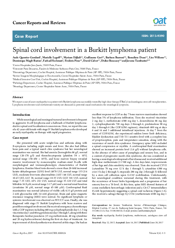 (PDF) Spinal cord involvement in a Burkitt lymphoma patient