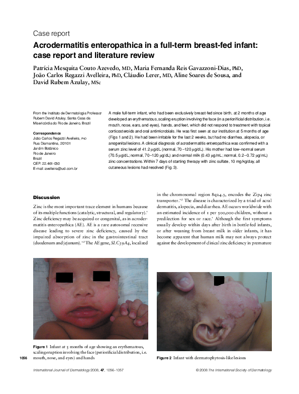 (PDF) Acrodermatitis enteropathica in a full-term breast-fed infant ...