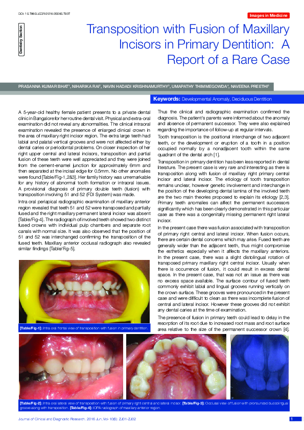 (PDF) Transposition with Fusion of Maxillary Incisors in Primary ...