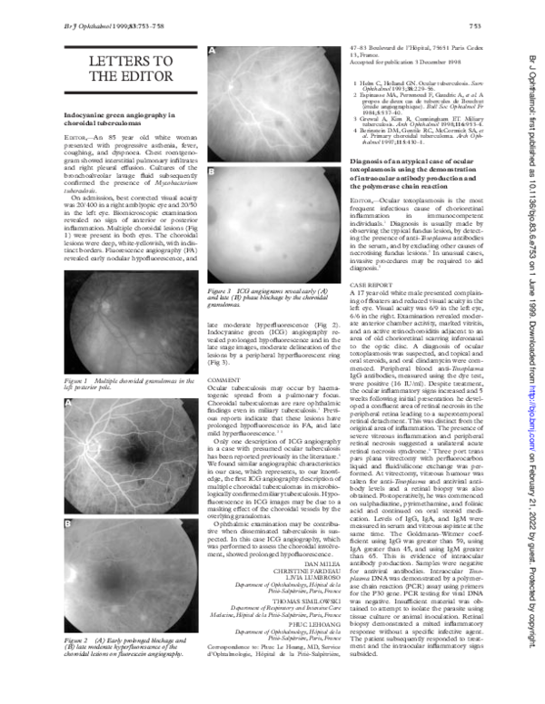 (PDF) Orbital haemangiopericytoma simulating an intraocular mass