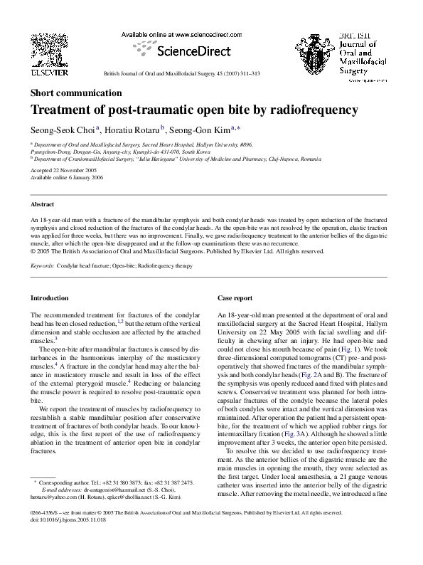 (PDF) Treatment of post-traumatic open bite by radiofrequency