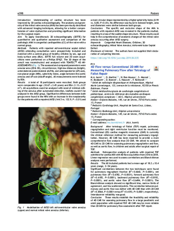 (PDF) 4D Flow versus Conventional 2D MRI for Measuring Pulmonary Flow ...