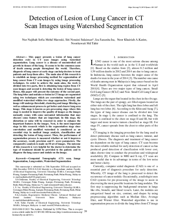 Pdf Detection Of Lesion Of Lung Cancer In Ct Scan Images Using