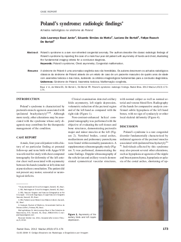 (PDF) Poland 's syndrome: radiologic findings