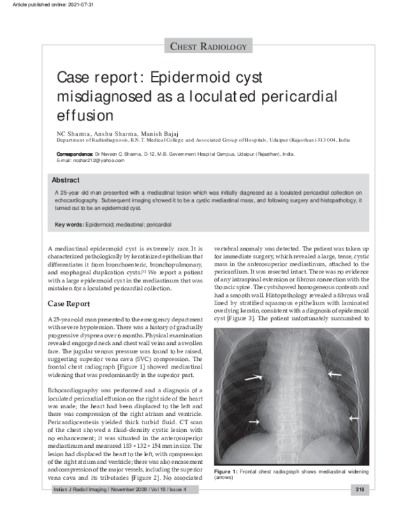 (PDF) Case report: Epidermoid cyst misdiagnosed as a loculated ...