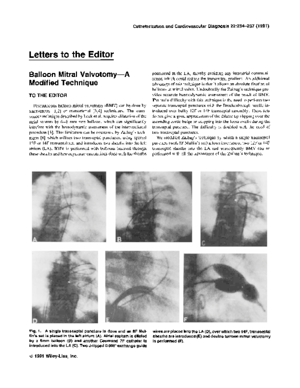 (PDF) Balloon mitral valvotomy—a modified technique