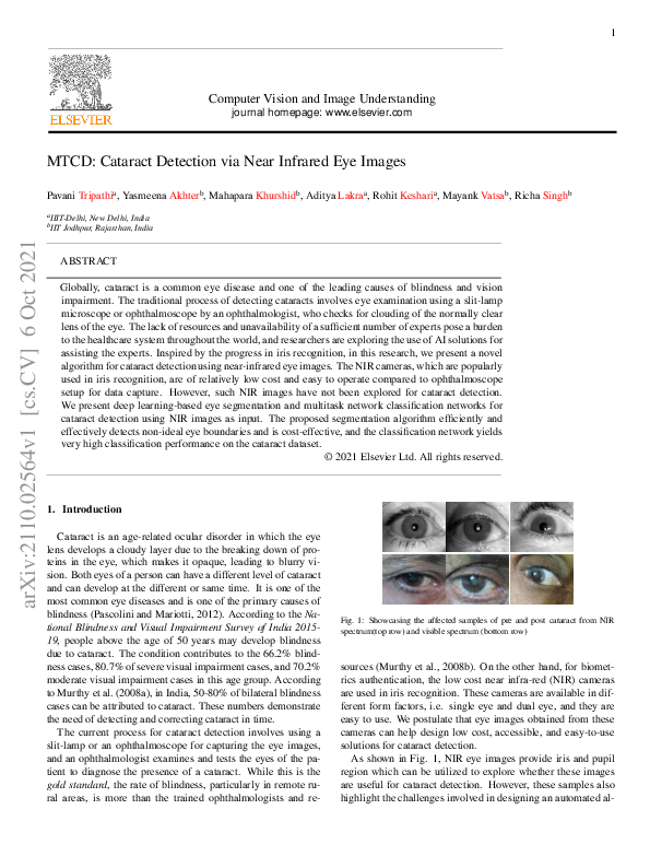 (PDF) MTCD: Cataract detection via near infrared eye images