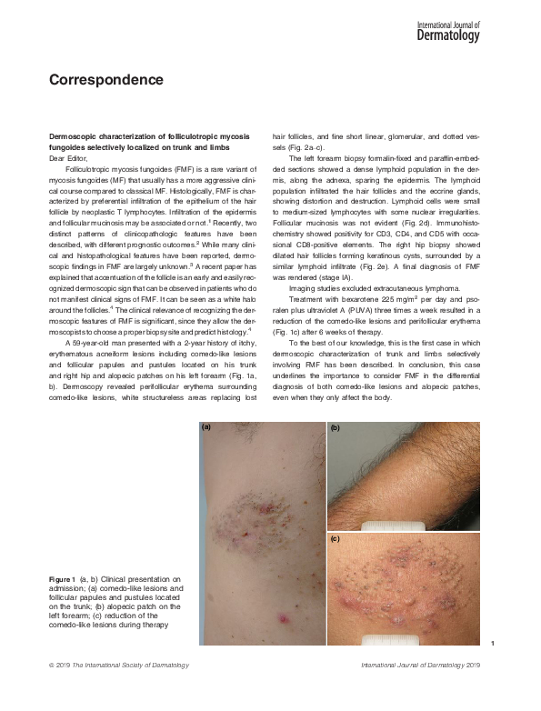 (PDF) Dermoscopic characterization of folliculotropic mycosis fungoides selectively localized on ...