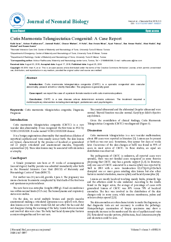 (PDF) Cutis Marmorata Telangiectatica Congenital: A Case Report