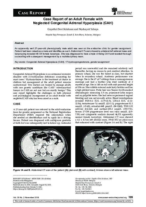 (PDF) Case Report of an Adult Female with Neglected Congenital Adrenal ...