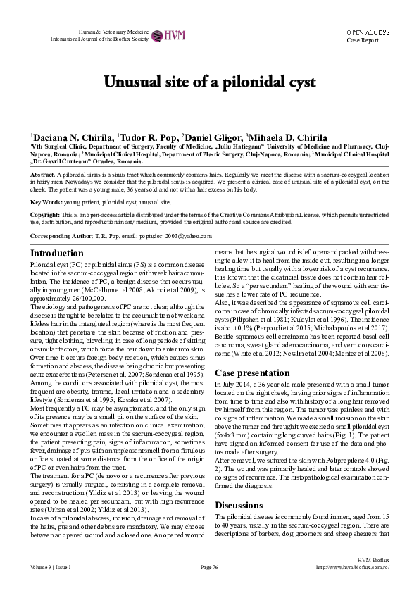 (PDF) Unusual site of a pilonidal cyst
