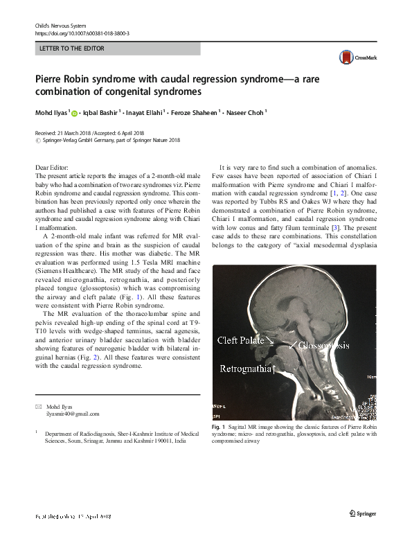 (PDF) Pierre Robin syndrome with caudal regression syndrome-a rare ...