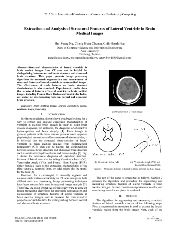 (PDF) Extraction and Analysis of Structural Features of Lateral ...