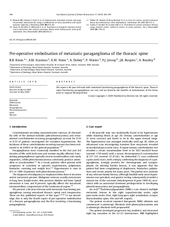 (PDF) Pre-operative embolisation of metastatic paraganglioma of the ...