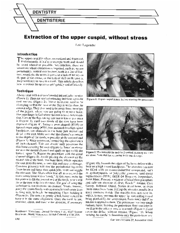 (PDF) Extraction of the upper cuspid, without stress