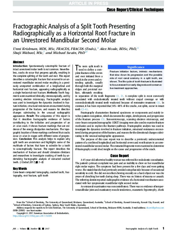 Pdf Fractographic Analysis Of A Split Tooth Presenting Radiographically As A Horizontal Root