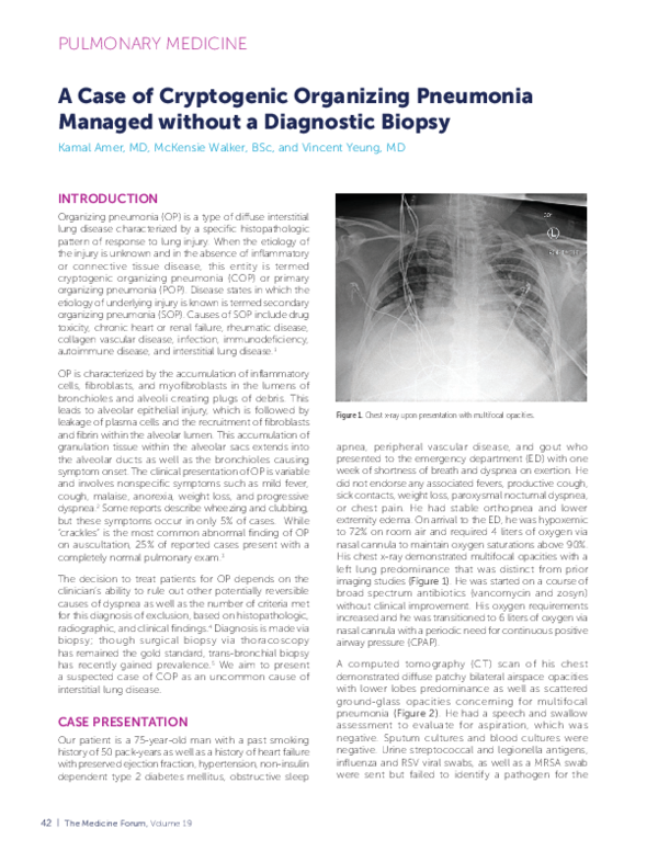 (PDF) A Case of Cryptogenic Organizing Pneumonia Managed without a ...