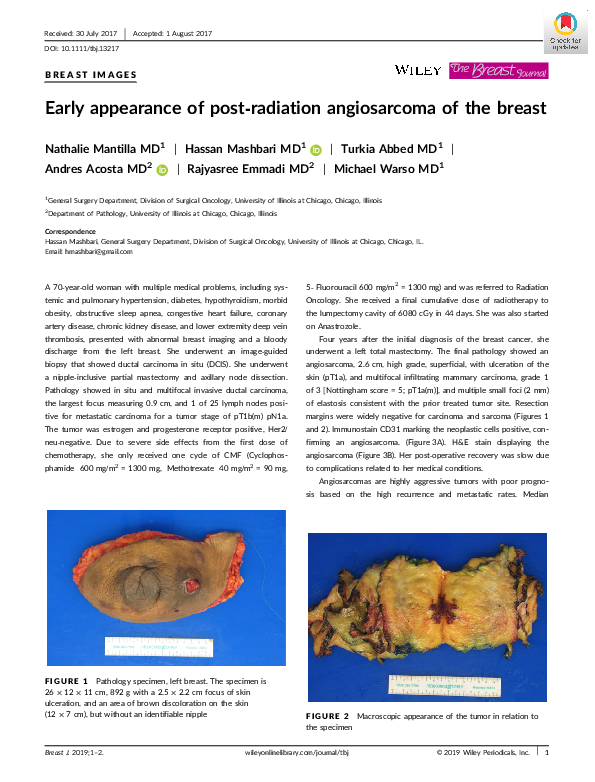 (PDF) Early appearance of post‐radiation angiosarcoma of the breast
