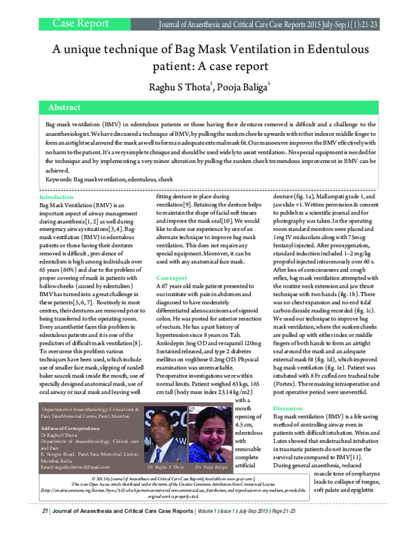 (PDF) A unique technique of Bag Mask Ventilation in Edentulous patient ...