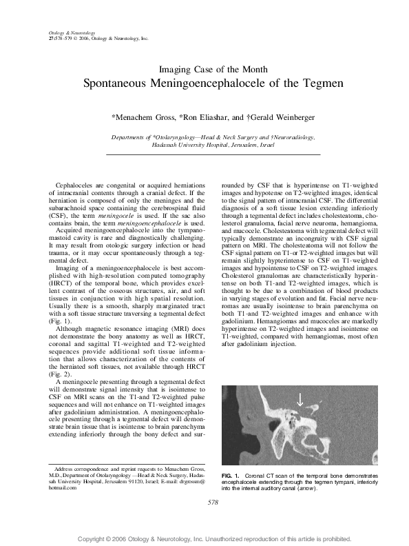 (PDF) Spontaneous Meningoencephalocele of the Tegmen