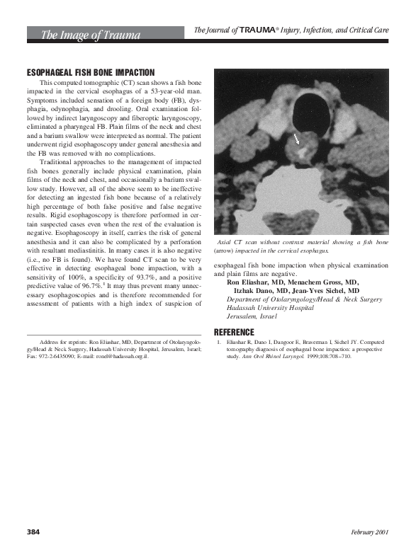 (PDF) Esophageal Fish Bone Impaction | Ron Eliashar - Academia.edu