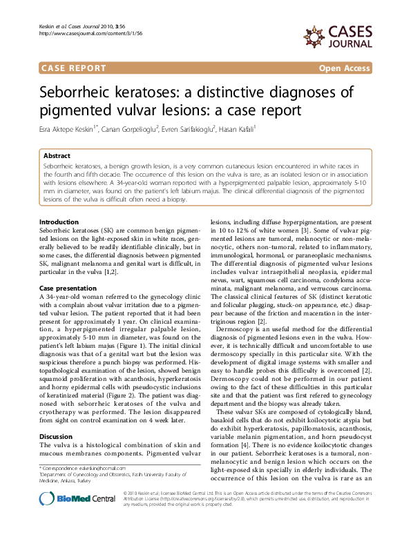 (PDF) Seborrheic keratoses: a distinctive diagnoses of pigmented vulvar ...