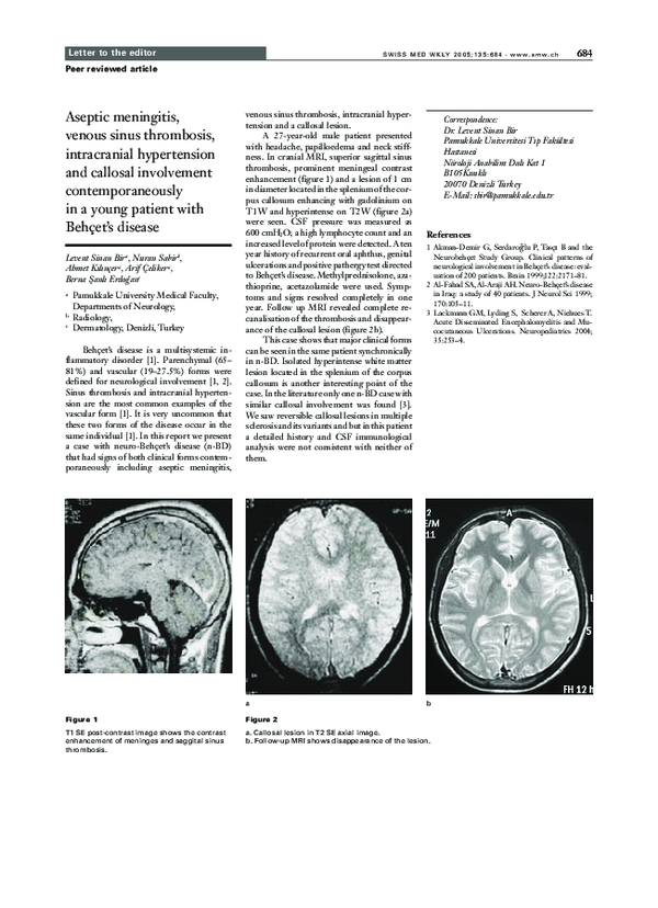 (PDF) Aseptic meningitis, venous sinus thrombosis, intracranial ...