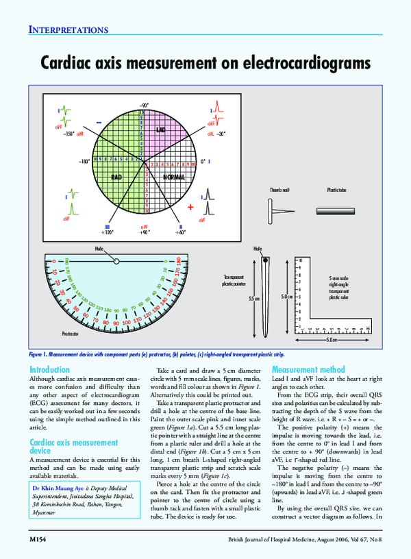 (PDF) Cardiac axis measurement on electrocardiograms