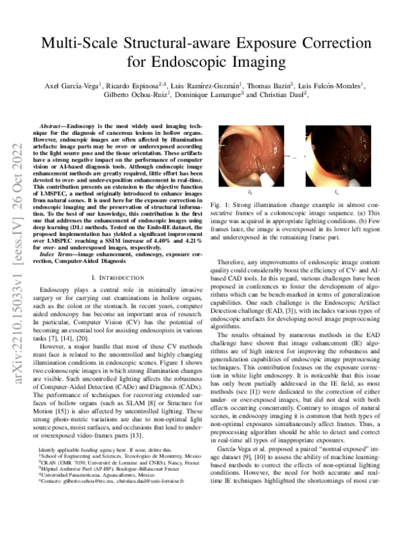 (PDF) Multi-Scale Structural-aware Exposure Correction for Endoscopic Imaging