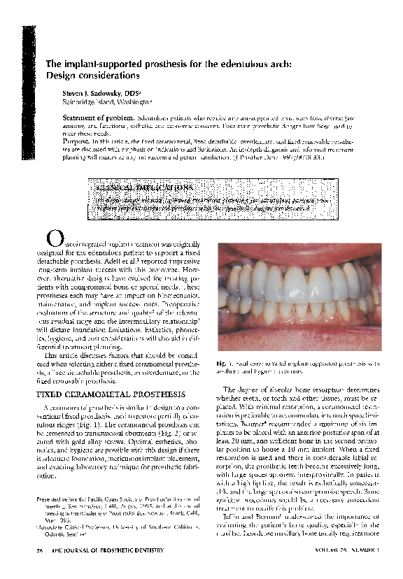 (PDF) The implant-supported prosthesis for the edentulous arch: Design ...