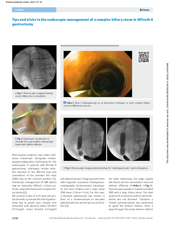 (PDF) Tips and tricks in the endoscopic management of a complex biliary ...