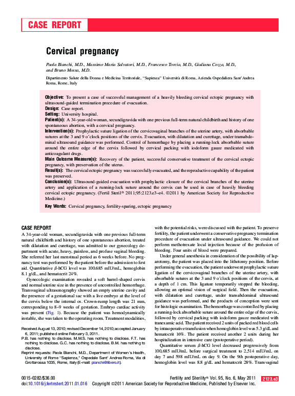 (PDF) Cervical pregnancy