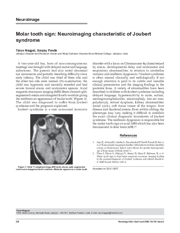 (PDF) Molar tooth sign: Neuroimaging characteristic of Joubert syndrome ...