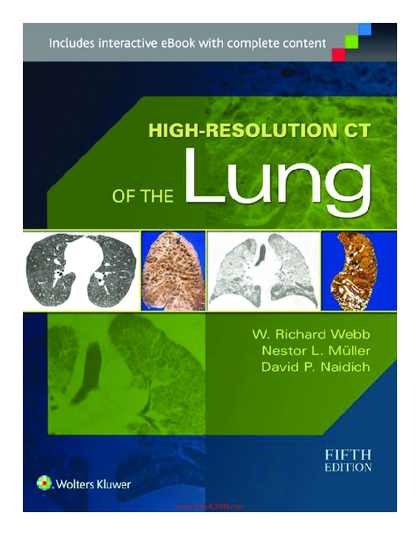 (PDF) HIGH RESOLUTION CT OF THE LUNG