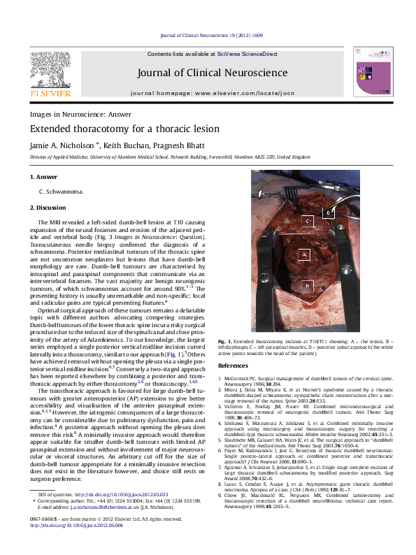 (PDF) Extended thoracotomy for a thoracic lesion