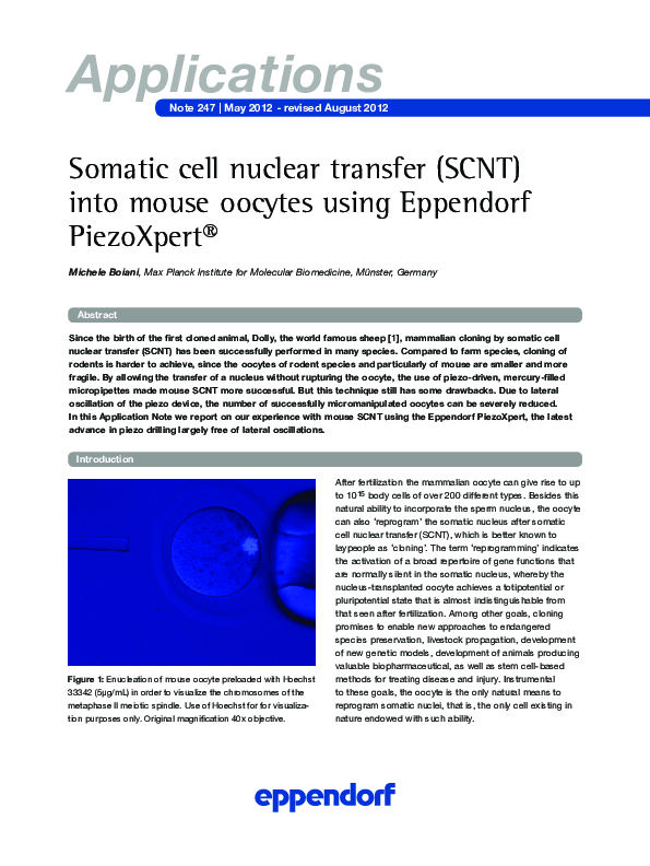 (PDF) Somatic cell nuclear transfer (SCNT) into mouse oocytes using ...