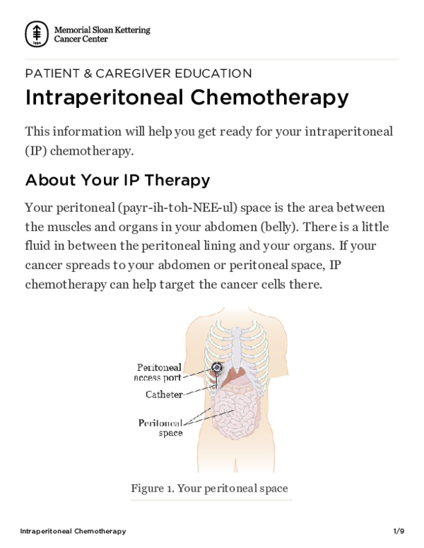 (PDF) Intraperitoneal chemotherapy