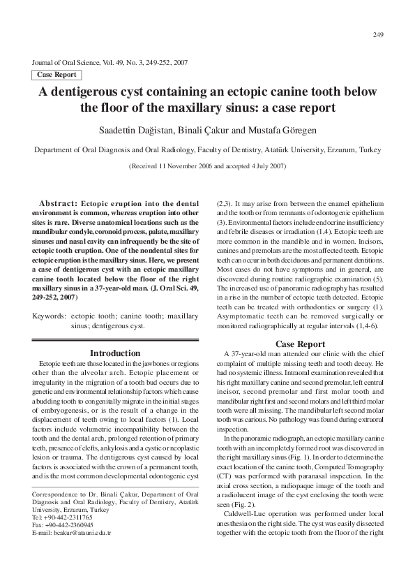(PDF) A dentigerous cyst containing an ectopic canine tooth below the ...